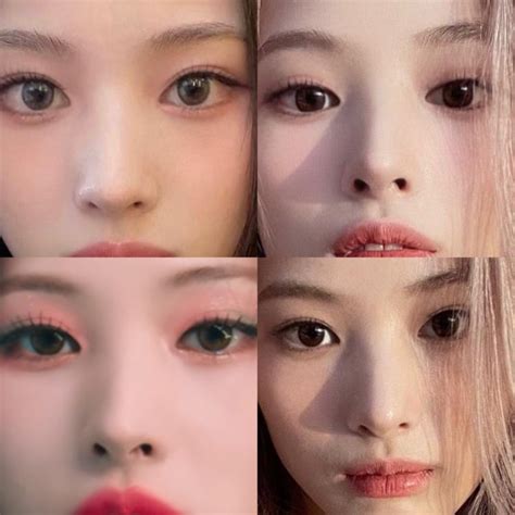 코 성형수술 질문 지식in