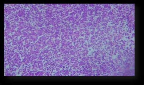 Histological Section In Parathyroid Gland Of Untreated Rat Control