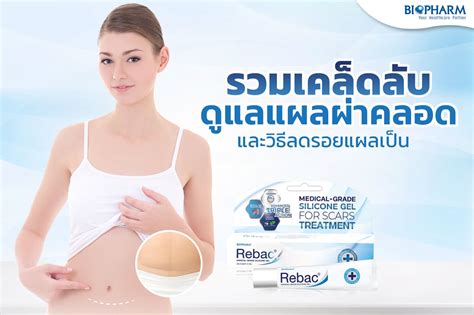 10 เคล็ดลับดูแลแผลผ่าคลอด พร้อมวิธีดูแลรอยแผลให้เนียนสวย