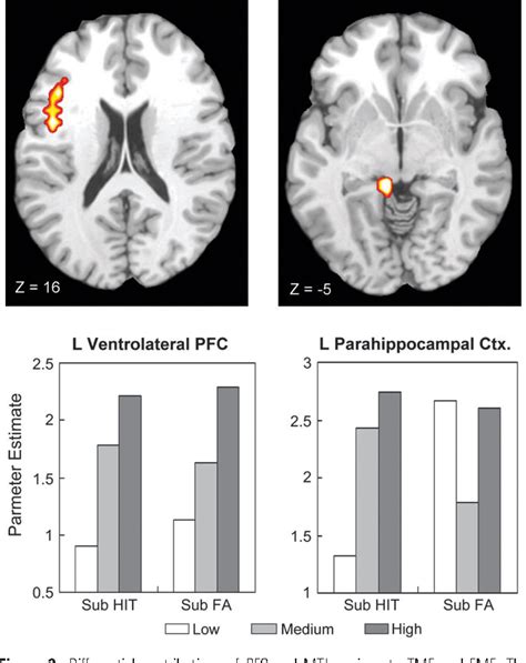 Figure 3 From Differential Contributions Of Prefrontal Medial Temporal And Sensory Perceptual