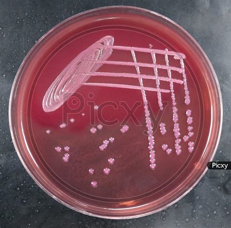 Macconkey Agar Lactose Fermentation