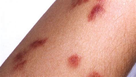 Oncogenic Viruses Flashcards Quizlet