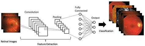 Application Of Deep Learning Framework For Early Prediction Of Diabetic Retinopathy