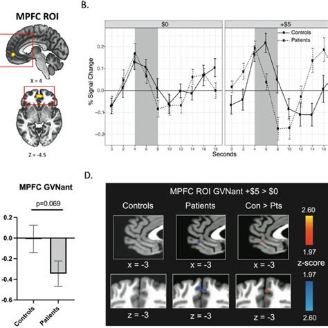Medial Prefrontal Cortex Activity During Reward Anticipation A Download Scientific Diagram