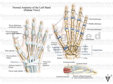 Case At A Glance 5th Finger Fracture And Surgical Repair — Illustrated