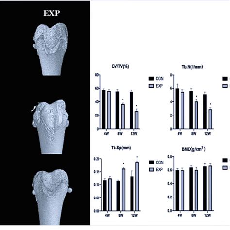 Measurement Diagram Dc Trochlear Depth Acb Sulcus Angle Download