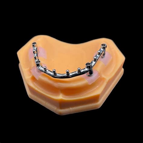 China Low Price Denture On Bar With Attachment Manufacturers Suppliers Factory Pricelist