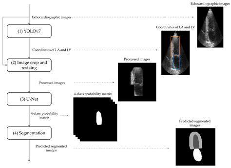 Echocardiogram View Classification By Deep Learning Model Download