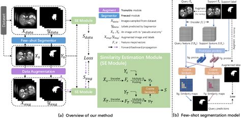 Unsupervised Augmentation Optimization For Few Shot Medical Image Segmentation Paper And Code