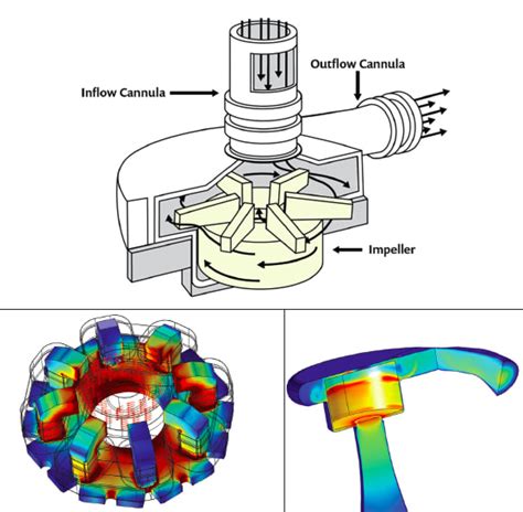 Enhancing Performance And Safety Of Medical Implantable Devices With Multiphysics Simulation