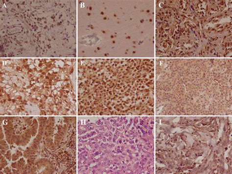 detection of oct4 variants oct4a and oct4b in different types of