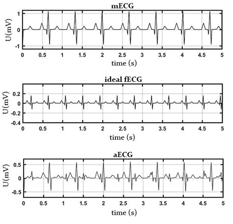 Example Of Input Synthetic Signals Download Scientific Diagram