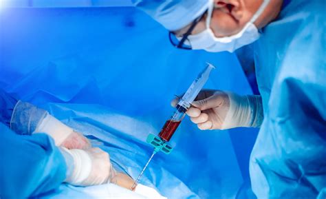 How Bone Marrow Transplant Is Done Unihealth Turkey