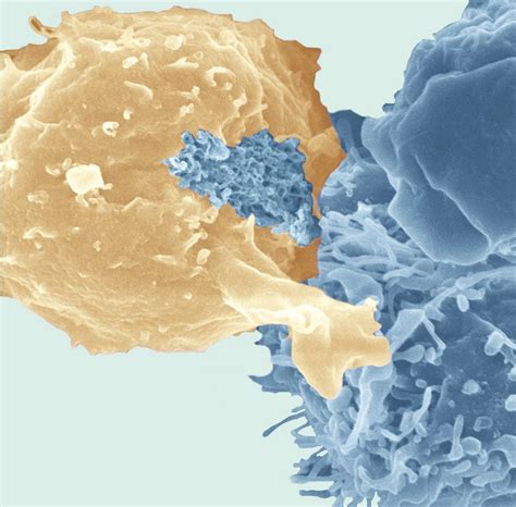 Antoine Gessain Oncogenic Virus Epidemiology And Pathophysiology Research Institut Pasteur
