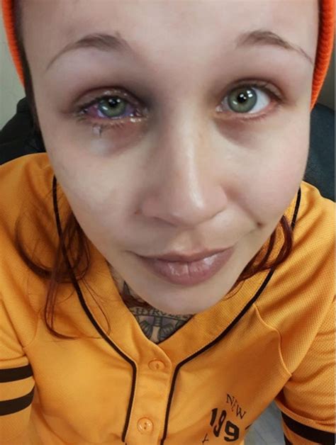 Model Catt Gallinger Ließ Sich Auge Tätowieren Mit Folgen Express