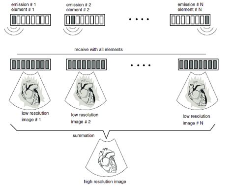 12 Principle Of The Synthetic Aperture Ultrasound Imaging The Media Download Scientific