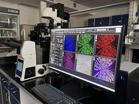 Confocal Laser Scanning Microscope Worldoftest