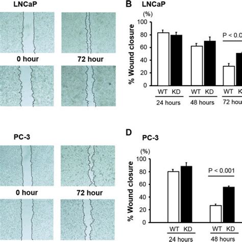 Correlation Of Hur Expression With Migration The Gap Closure Assay Was Download Scientific