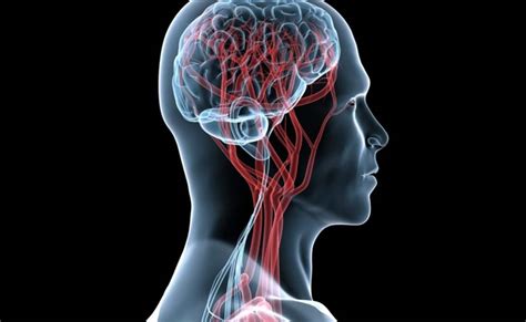 ¿quiénes Corren Mayor Riesgo De Sufrir Un Derrame Cerebral Infobae