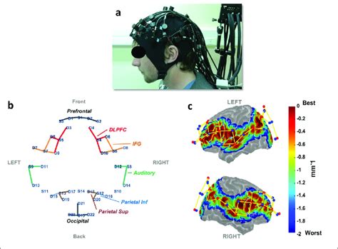 Graphic Representation Of Fnirs Data Collection A Photography Of The