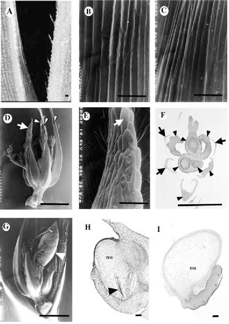 Figure 1 From Superwoman1 And Drooping Leaf Genes Control Floral Organ Identity In Rice