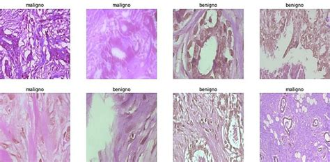 Sample Histopathology Images Obtained From The Source Download Scientific Diagram