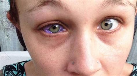 Ink For The Eyes A Guide To Eye Tattooing Tattooed Images
