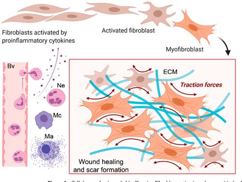 Figure 1 From Scarring And Skin Fibrosis Reversal With Regenerative Surgery And Stem Cell