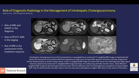 Role Of Diagnostic Radiology In The Management Of Intrahepatic