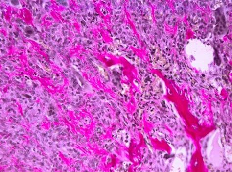 Microscopic Image Evg X20 Elastica Van Gieson Staining Reveals A