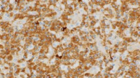 Confirm Anti Kappa Rabbit Polyclonal Primary Antibody