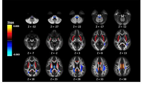 Figure 6 From An Intracellular Isotropic Diffusion Signal Is Positively