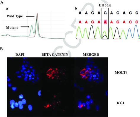 A Typical Elution Profiles Of Dhplc Analysis And Sequencing A
