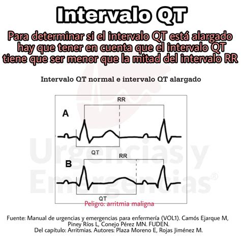 ZONA DE SALUD DE OFRA Sabes Que El QT Largo Puede Generar Arritmias Mortales