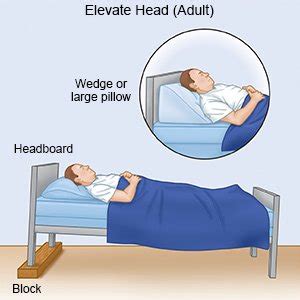 Nasal Contusion What You Need To Know