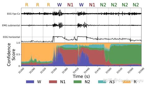 时间序列分割 U Time A fully convolutional network for time series segmentation applied to sleep