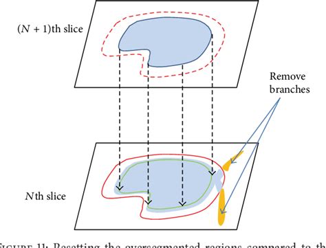 Figure 11 From Fast And Accurate Semiautomatic Segmentation Of