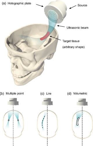 Holographic Lenses Focus Ultrasound For Brain Imaging Physics World