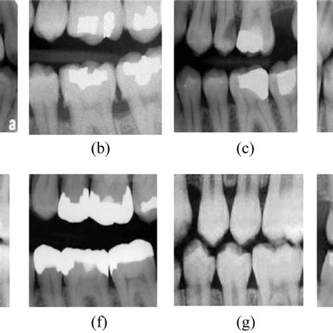Input Dental Caries Image Row 1 A Sample 7 B Sample 8 C Sample 9