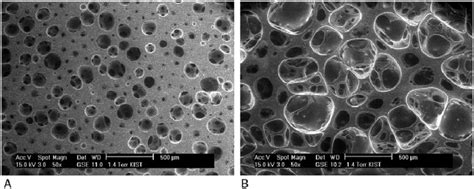Microscopic Structure Of A Wet Foam Dressing Material Medifoam By Download Scientific Diagram