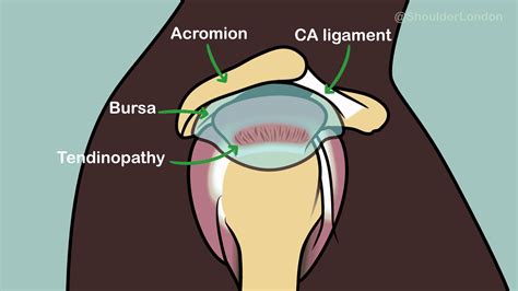 Subacromial Space