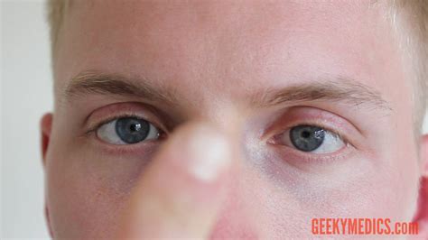 Examination Of The Eyes And Vision Osce Guide Geeky Medics
