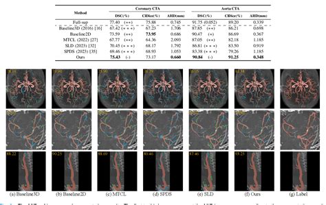 Figure 1 From 3d Vascular Segmentation Supervised By 2d Annotation Of Maximum Intensity