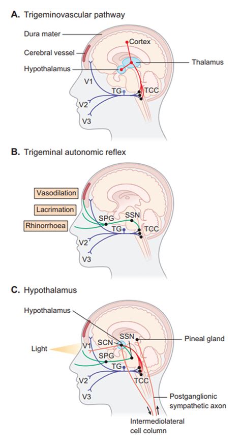 Trigeminal Autonomic Cephalalgias Healio Clinical Guidance