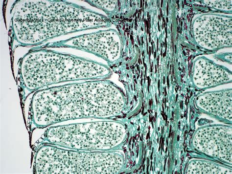 Pinus Ovulate Cone Labeled