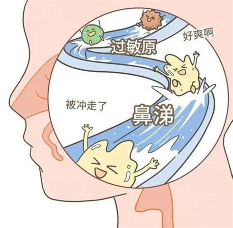 小儿推拿杨晓：什么是儿童上气道咳嗽综合征？有啥表现，如何治疗 知乎
