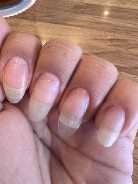 Celebrating My Overlay Lasting 3 Weeks After Struggling With Peeling Rdiygelnails