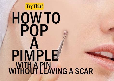 Pin On Acne