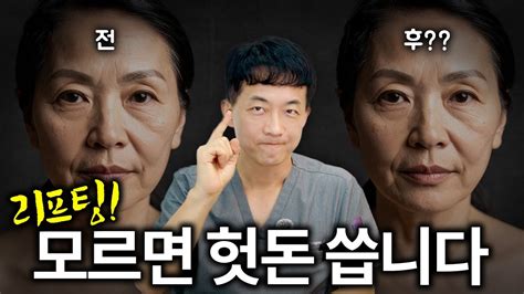 리프팅 시술 총정리 나한테 맞는 시술은 따로 있다 Youtube