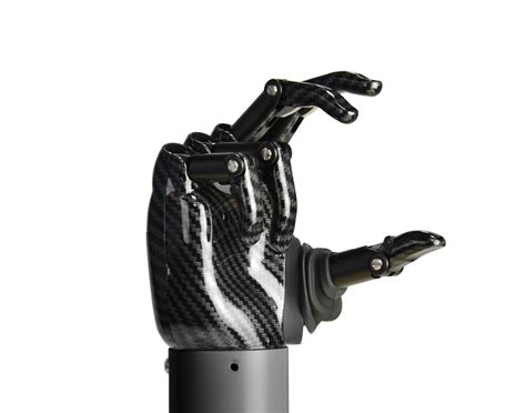 睿思智能仿生手 假肢 德林假肢 德林义肢康复辅具 一家装配全国服务 专业假肢矫形器